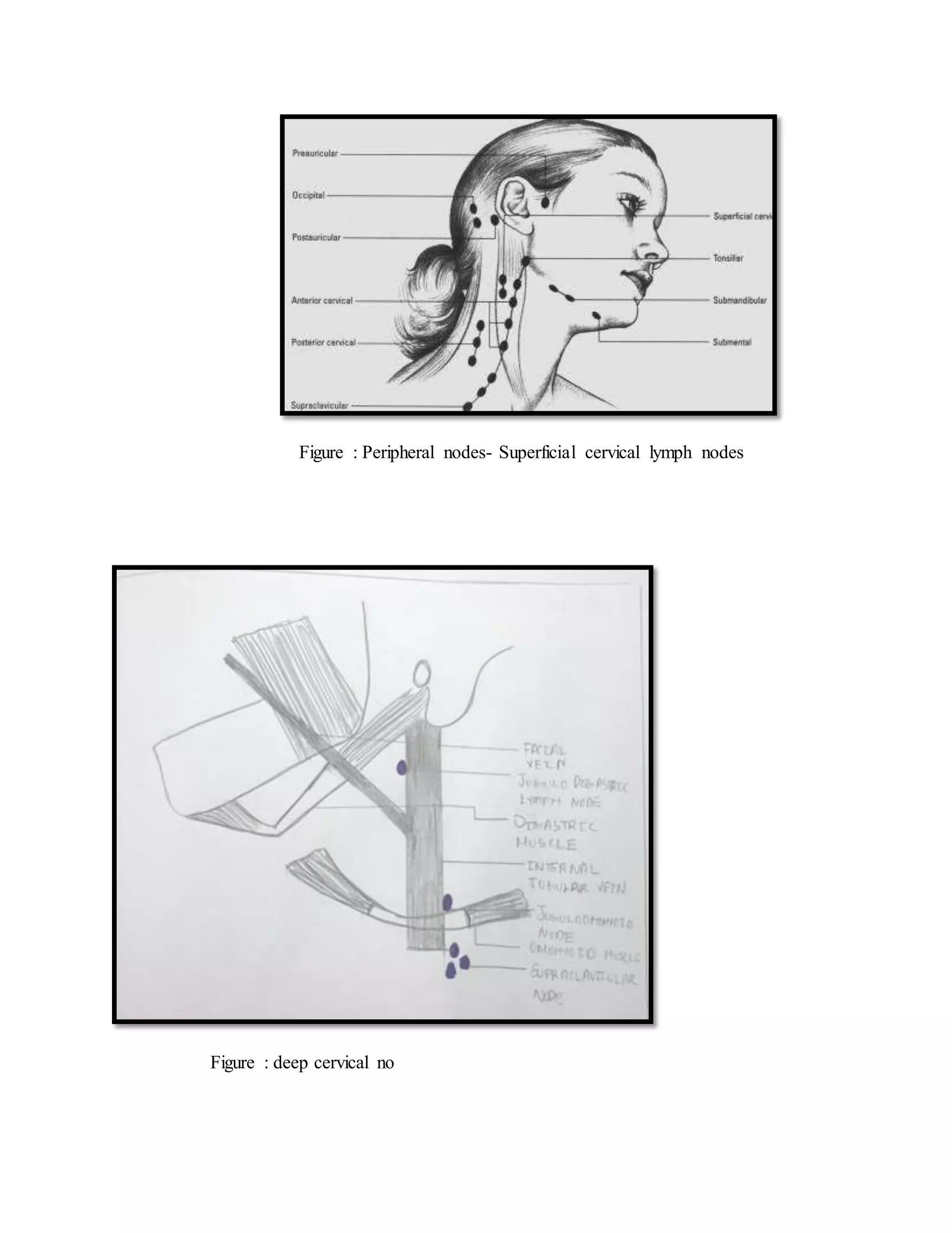 LYMPH NODES OF HEAD AND NECK AND DIFFERENTIAL DIAGNOSIS OF CERVICAL ...