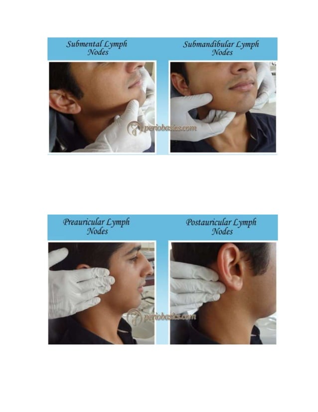LYMPH NODES OF HEAD AND NECK AND DIFFERENTIAL DIAGNOSIS OF CERVICAL ...