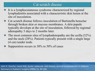 Lymph nodes of head and neck: Normal anatomy and applied aspect | PPTX