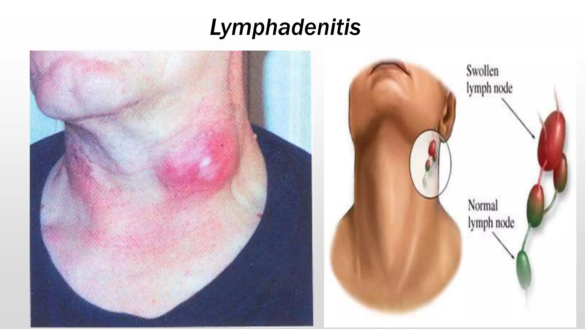 Lymph Node - A Histologcal Overview | PPTX