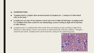 Lymphocytosis | PPTX