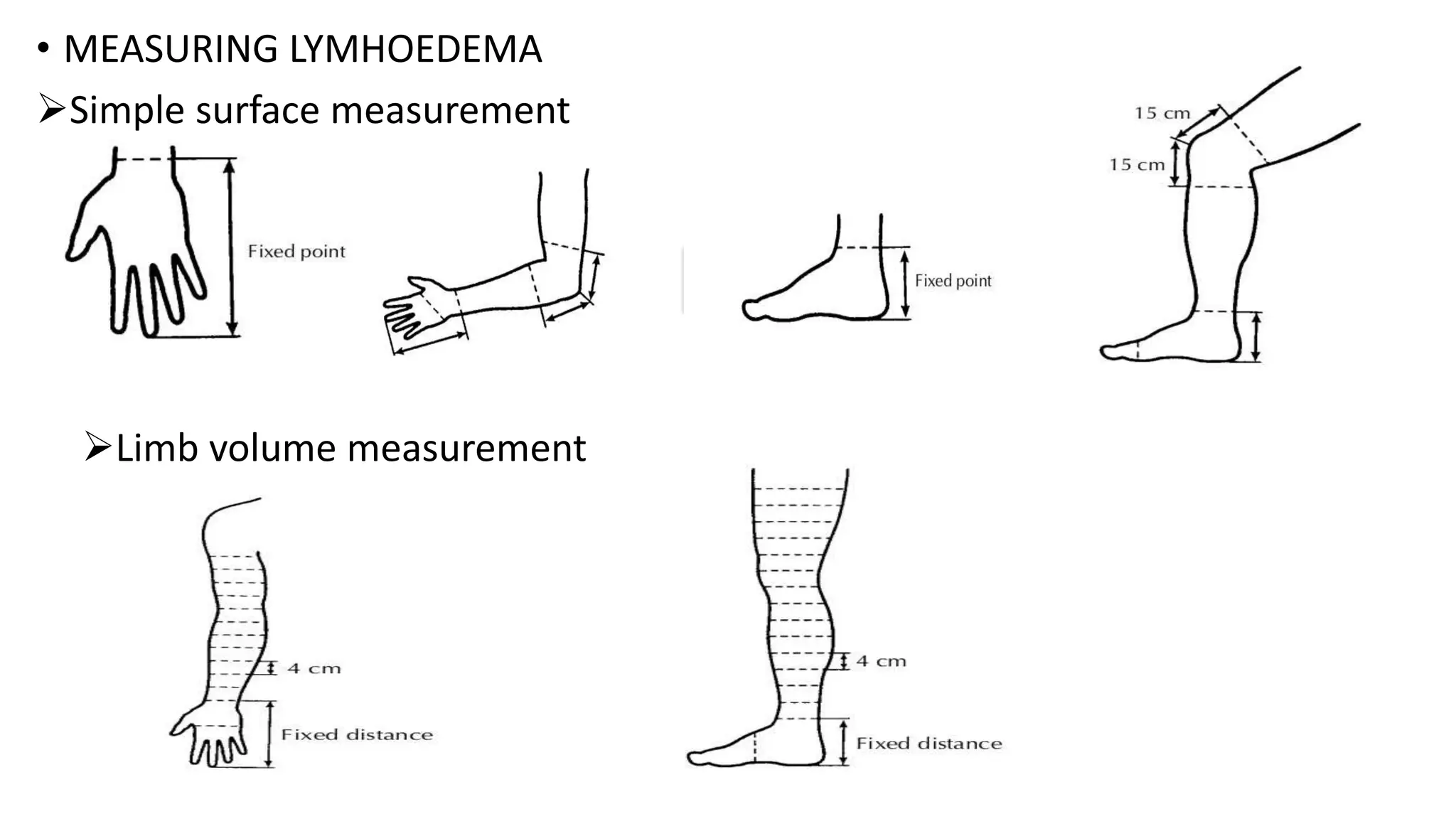 Lymphoedema Physiotherapy management | PPTX