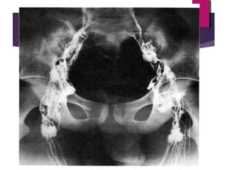 Lymphography rad 205-2013 | PPT