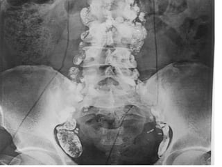 Lymphography rad 205-2013 | PPT