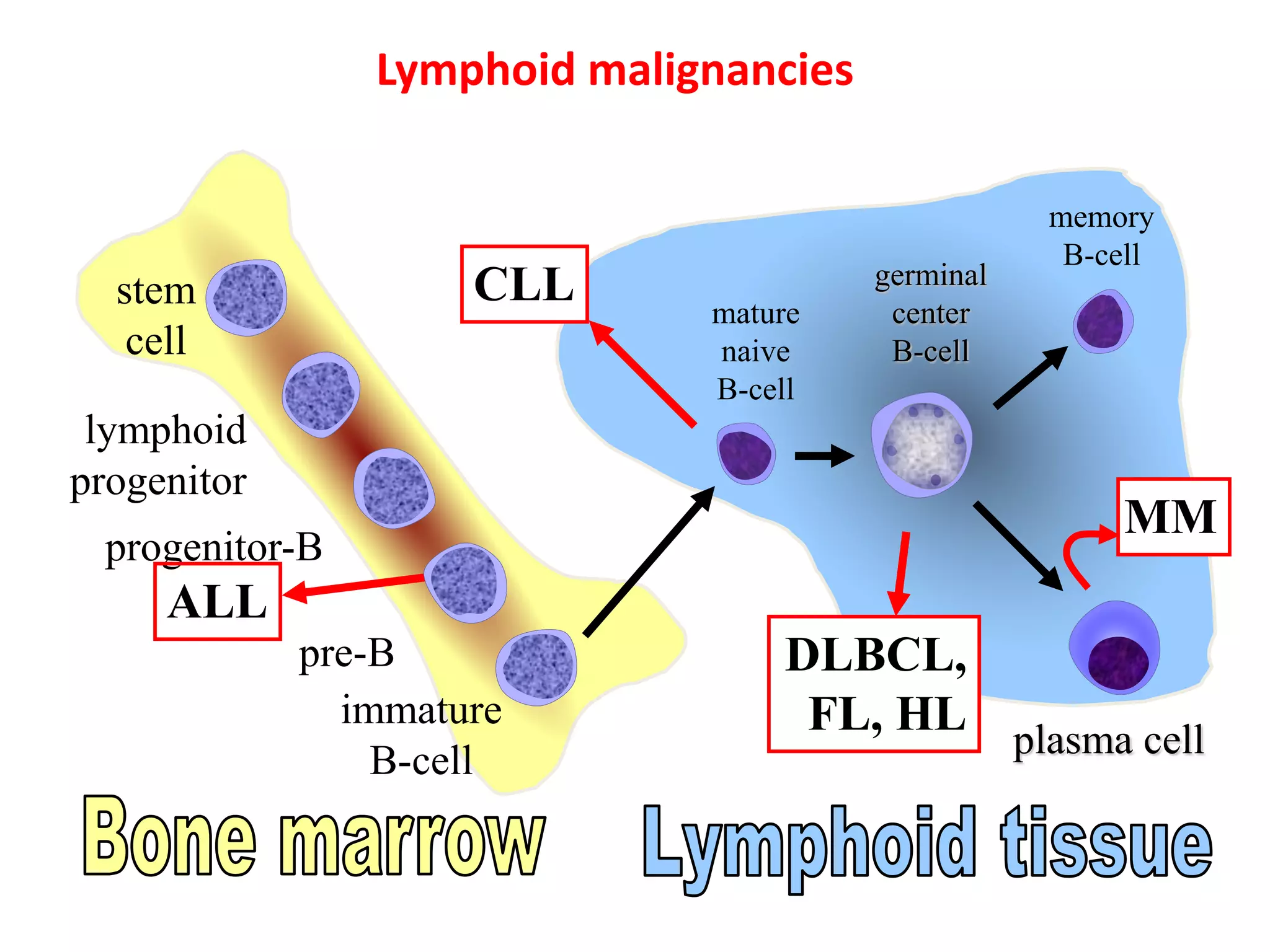 Lymphoid malignancies | PPTX | Blood Disorders | Diseases and Conditions
