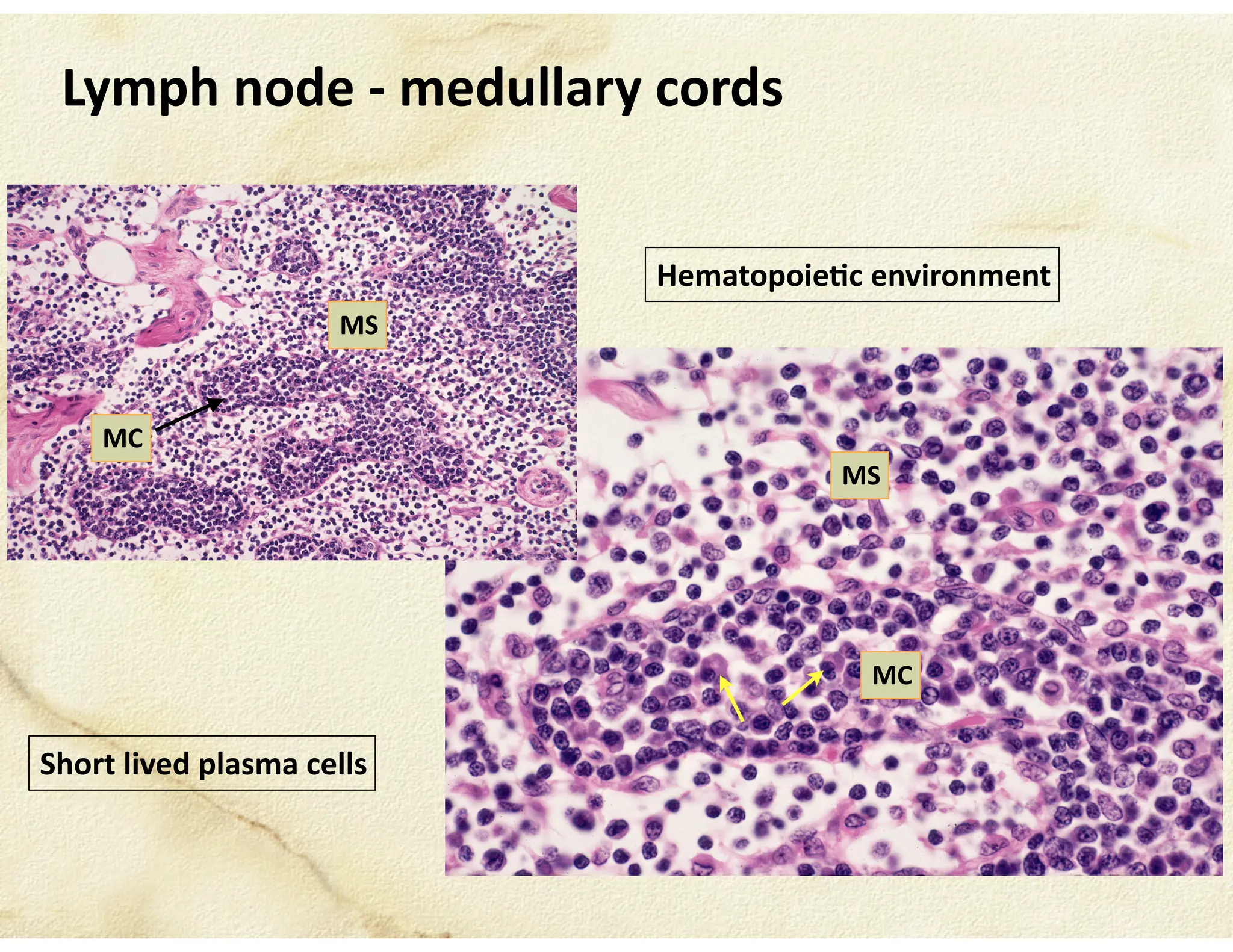 Lymphoid organs trafficking lymphoma 2021.pdf