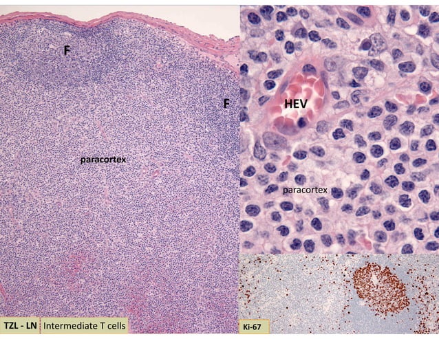 Lymphoid organs trafficking lymphoma 2021.pdf