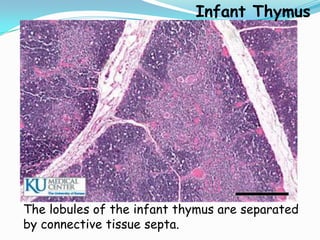 Lymphoid System By Yapa Wijeratne | PPT