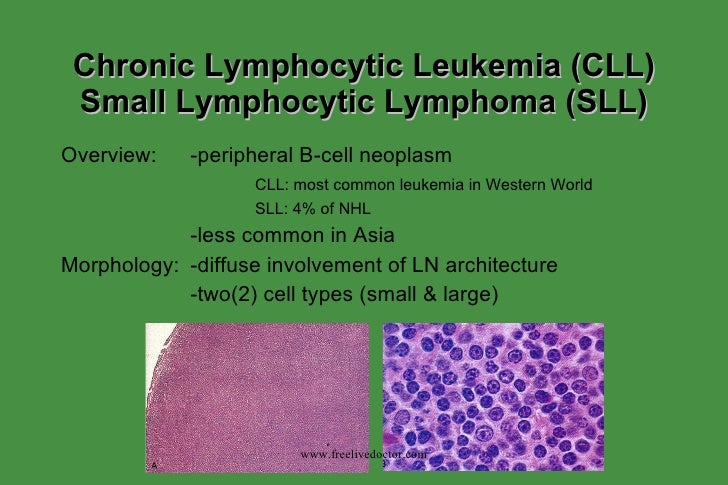 Lymphoma
