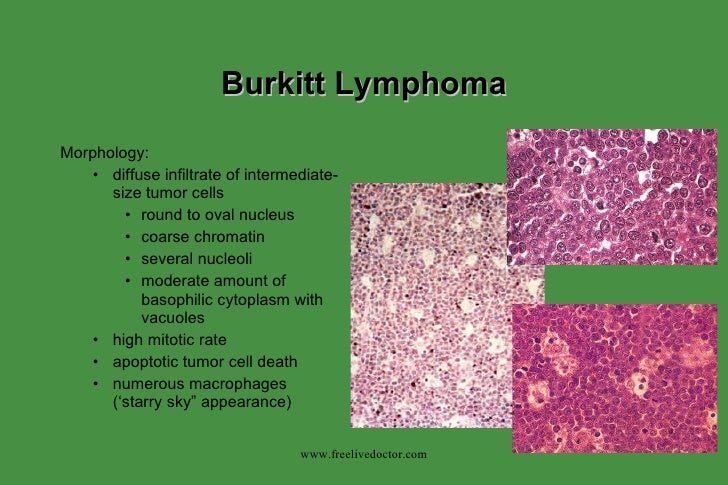 Lymphoma