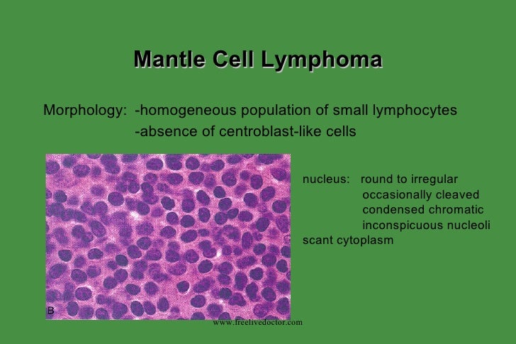 Lymphoma