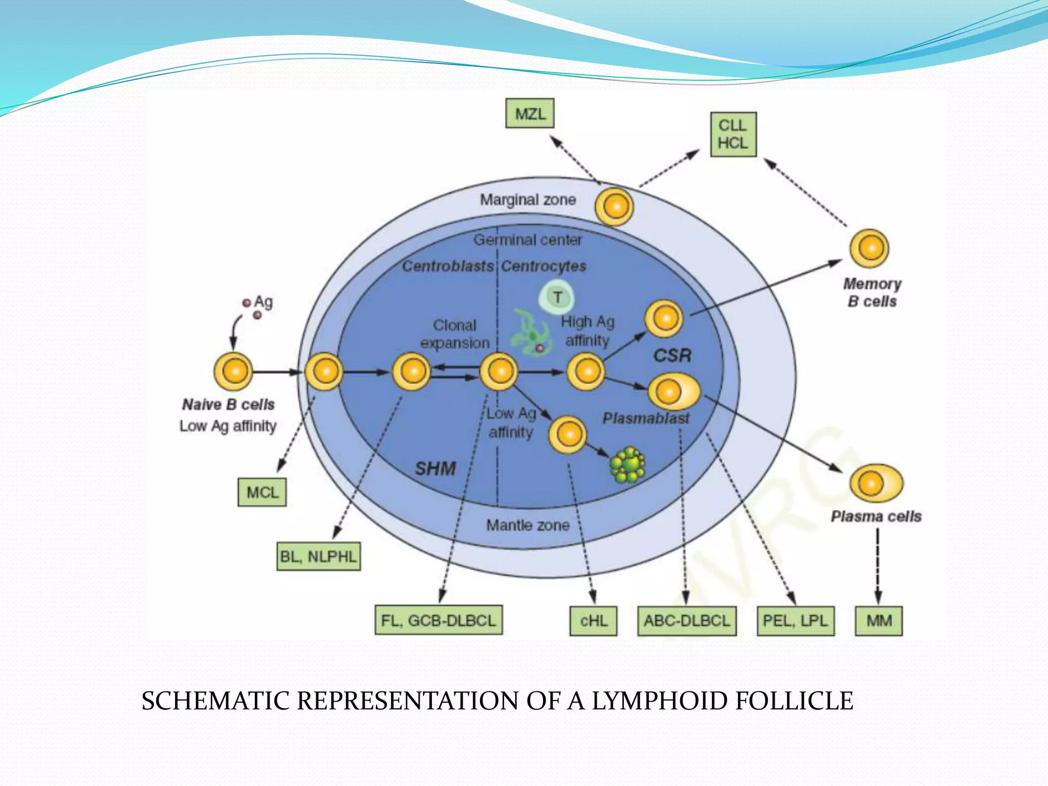 Lymphoma | PPTX