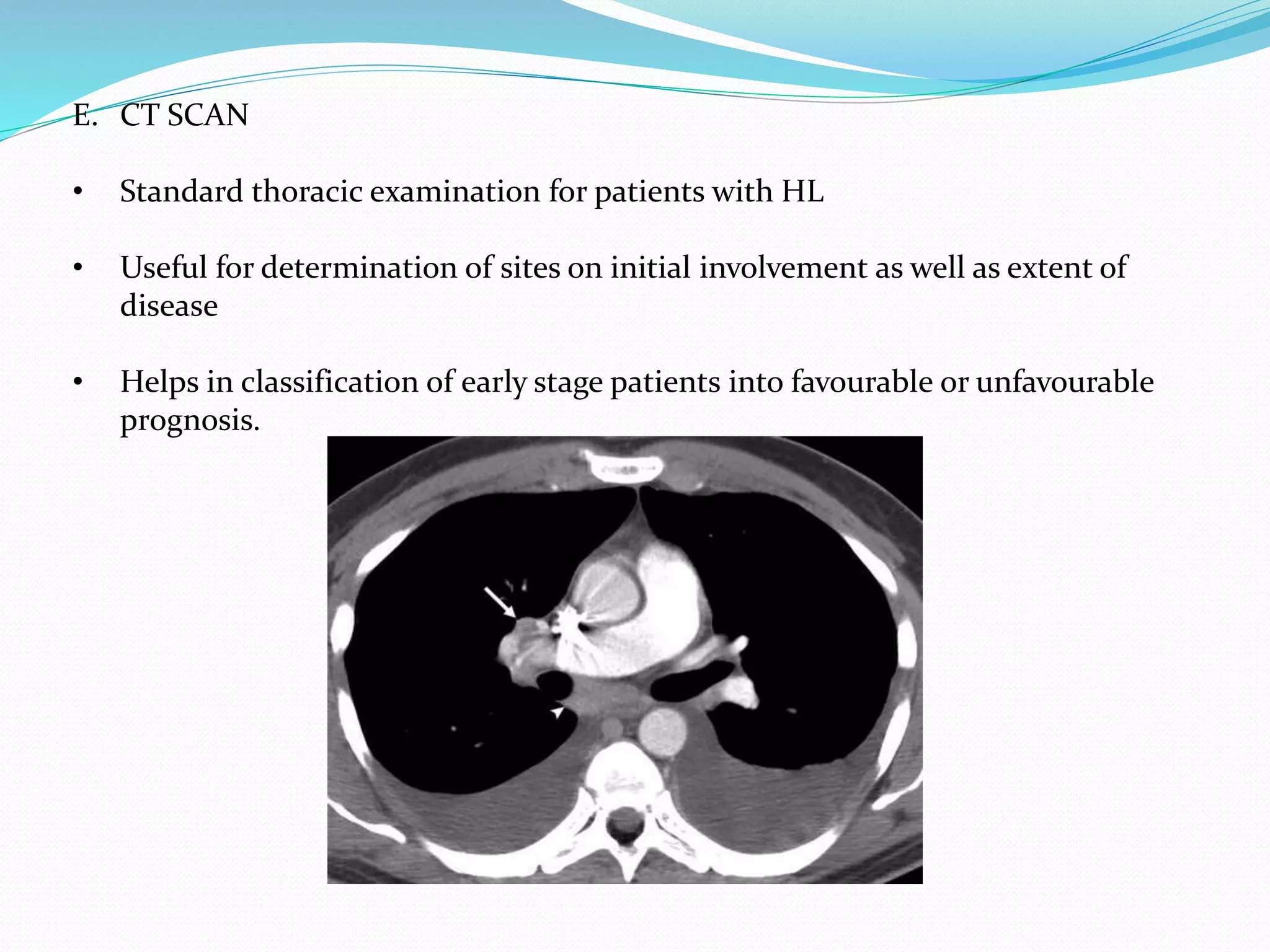 Lymphoma | PPTX