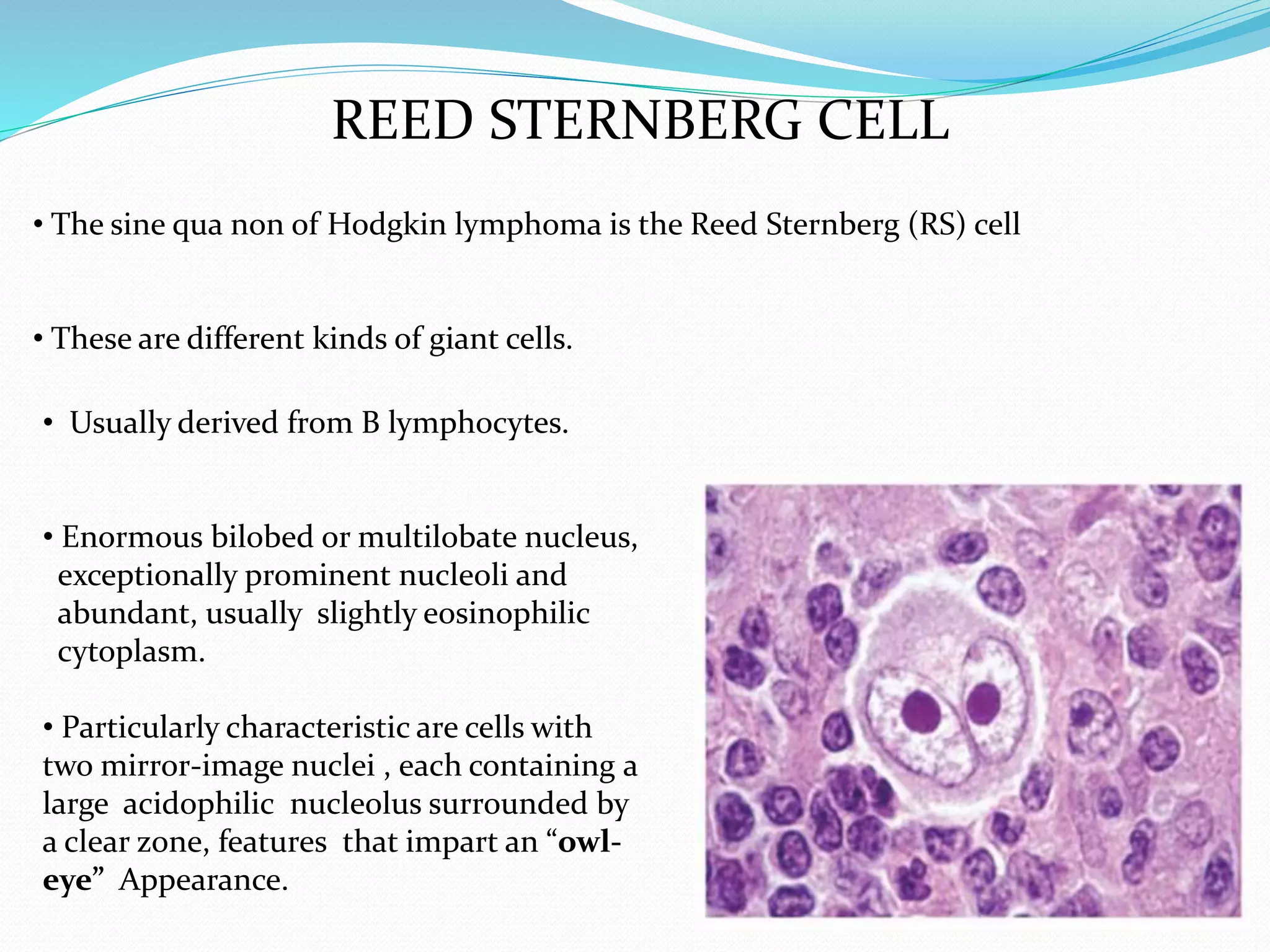 Lymphoma | PPTX