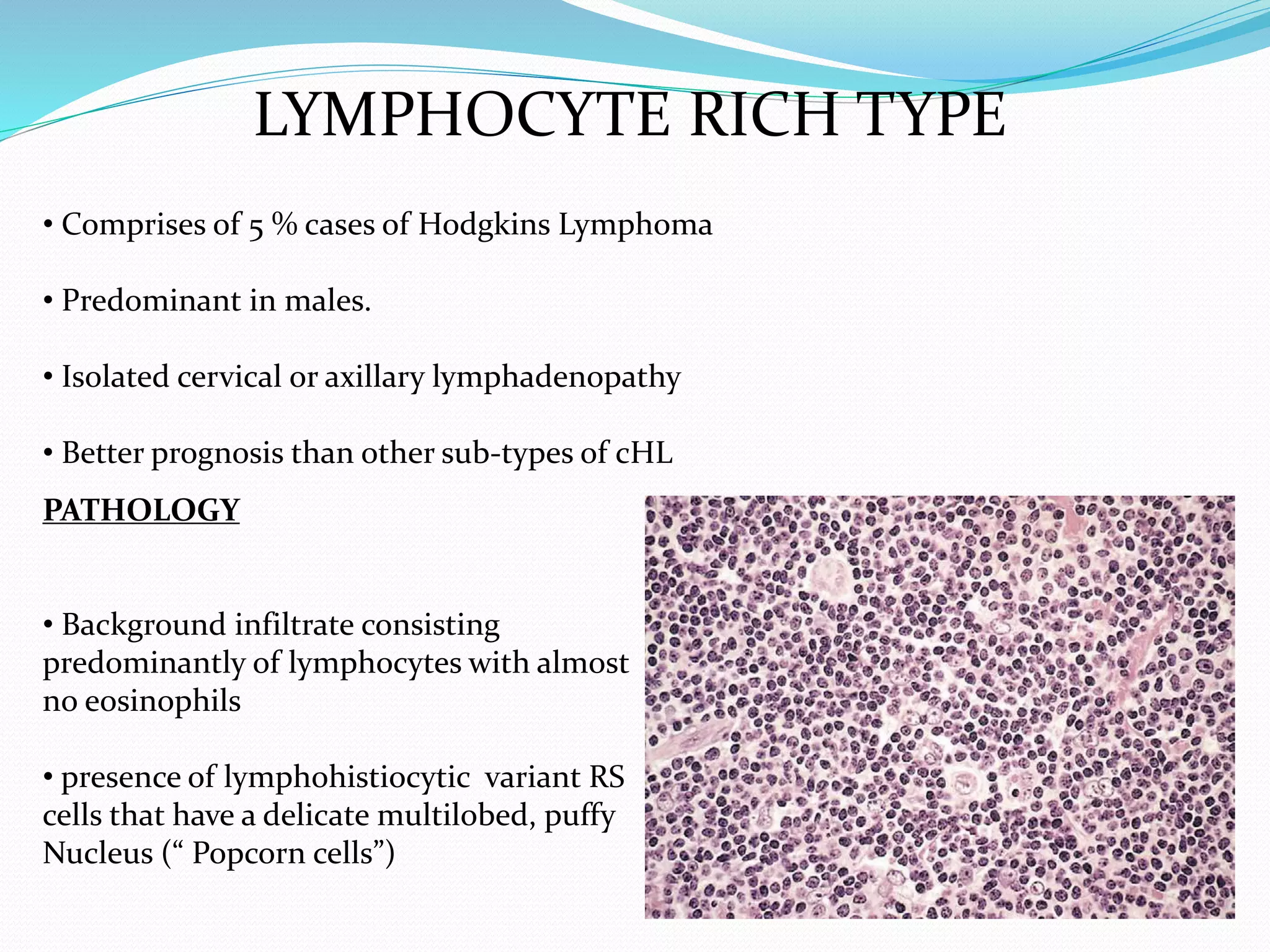 Lymphoma | PPTX