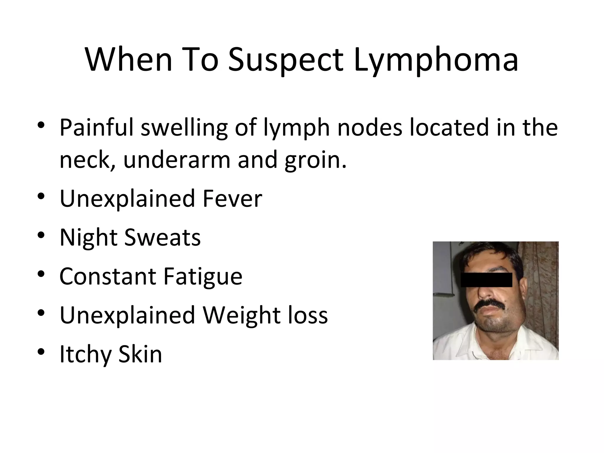 Lymphoma | PPT