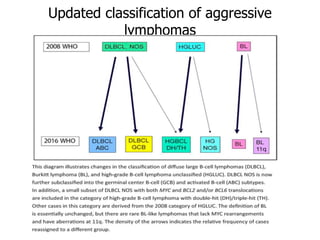Lymphomas | PPT