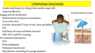 Lymphoma | PPTX | Cancer | Diseases and Conditions