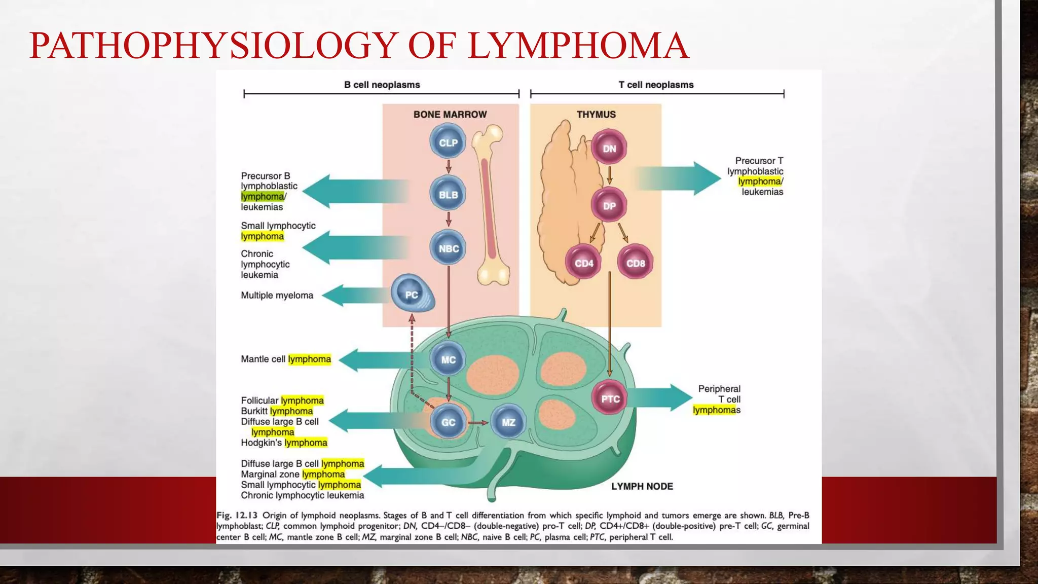 Lymphoma | PPTX | Cancer | Diseases and Conditions