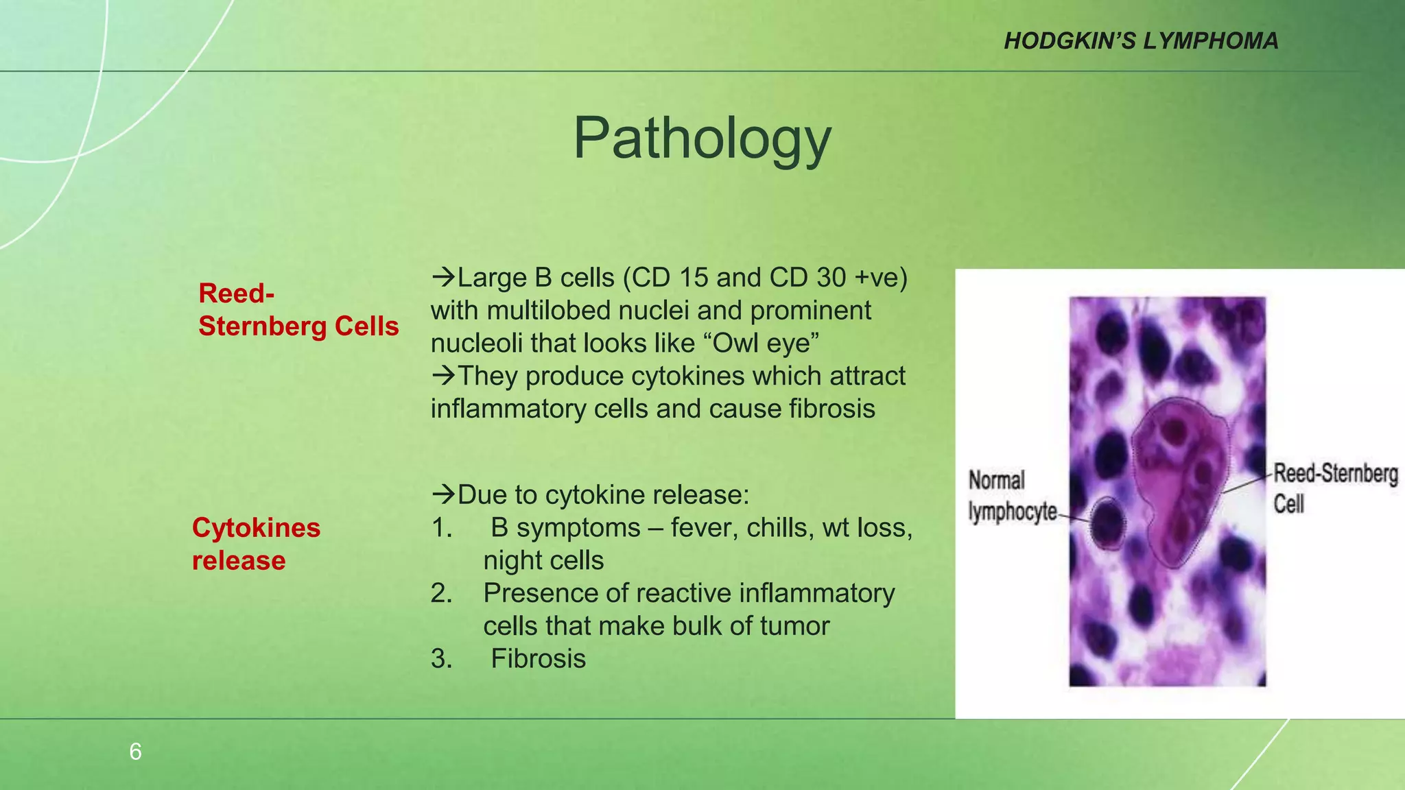 LYMPHOMA | PPTX
