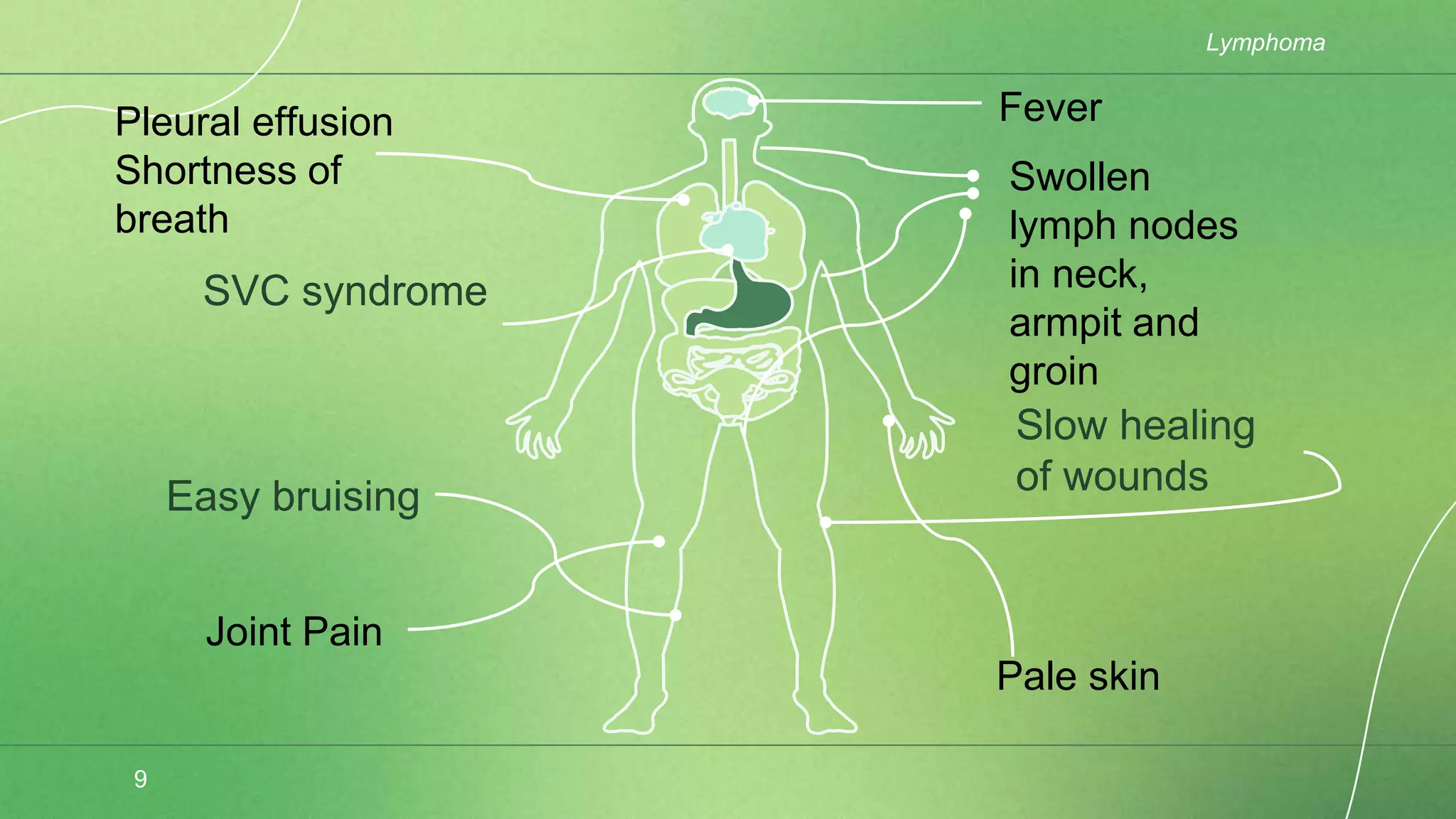 LYMPHOMA | PPTX