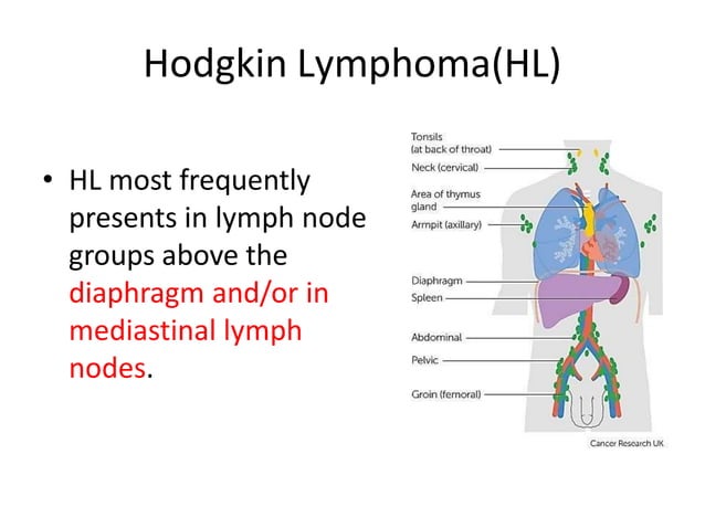 lymphoma and its treatment and nursing management.pptx