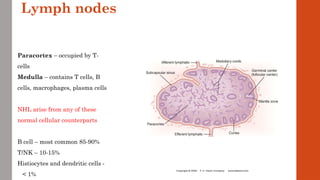 Lymphoma types and examination multiple mylar plasma cell lipid storage ...
