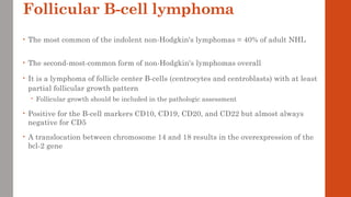 Lymphoma types and examination multiple mylar plasma cell lipid storage ...
