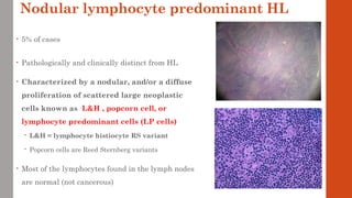 Lymphoma types and examination multiple mylar plasma cell lipid storage ...