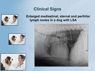 Lymphoma types and examination multiple mylar plasma cell lipid storage ...