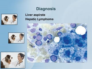 Lymphoma types and examination multiple mylar plasma cell lipid storage ...