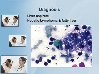 Lymphoma types and examination multiple mylar plasma cell lipid storage ...