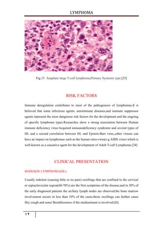 Lymphoma | PDF