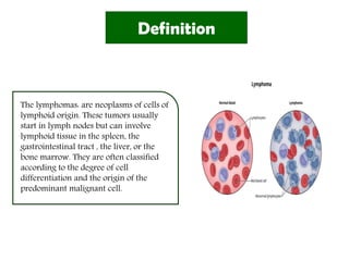 Lymphoma Medical surgical nursing..).pdf