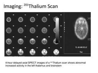 Neuroradiology | PPT