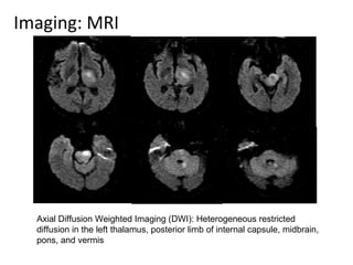 Neuroradiology | PPT