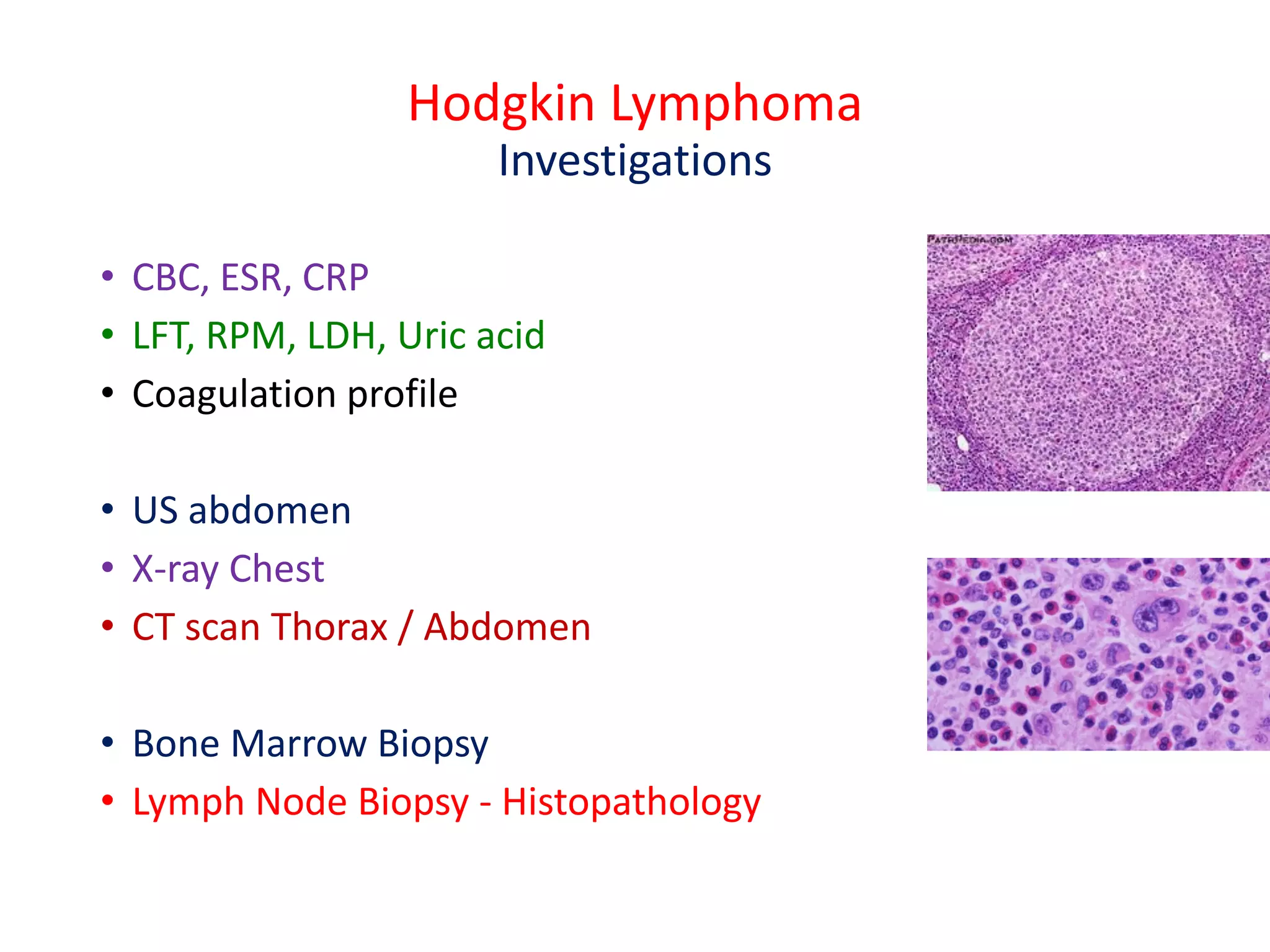 Lymphoma in children 2021 | PDF