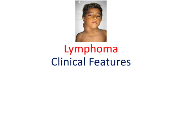 Lymphoma in children 2021 | PDF | Blood Disorders | Diseases and Conditions