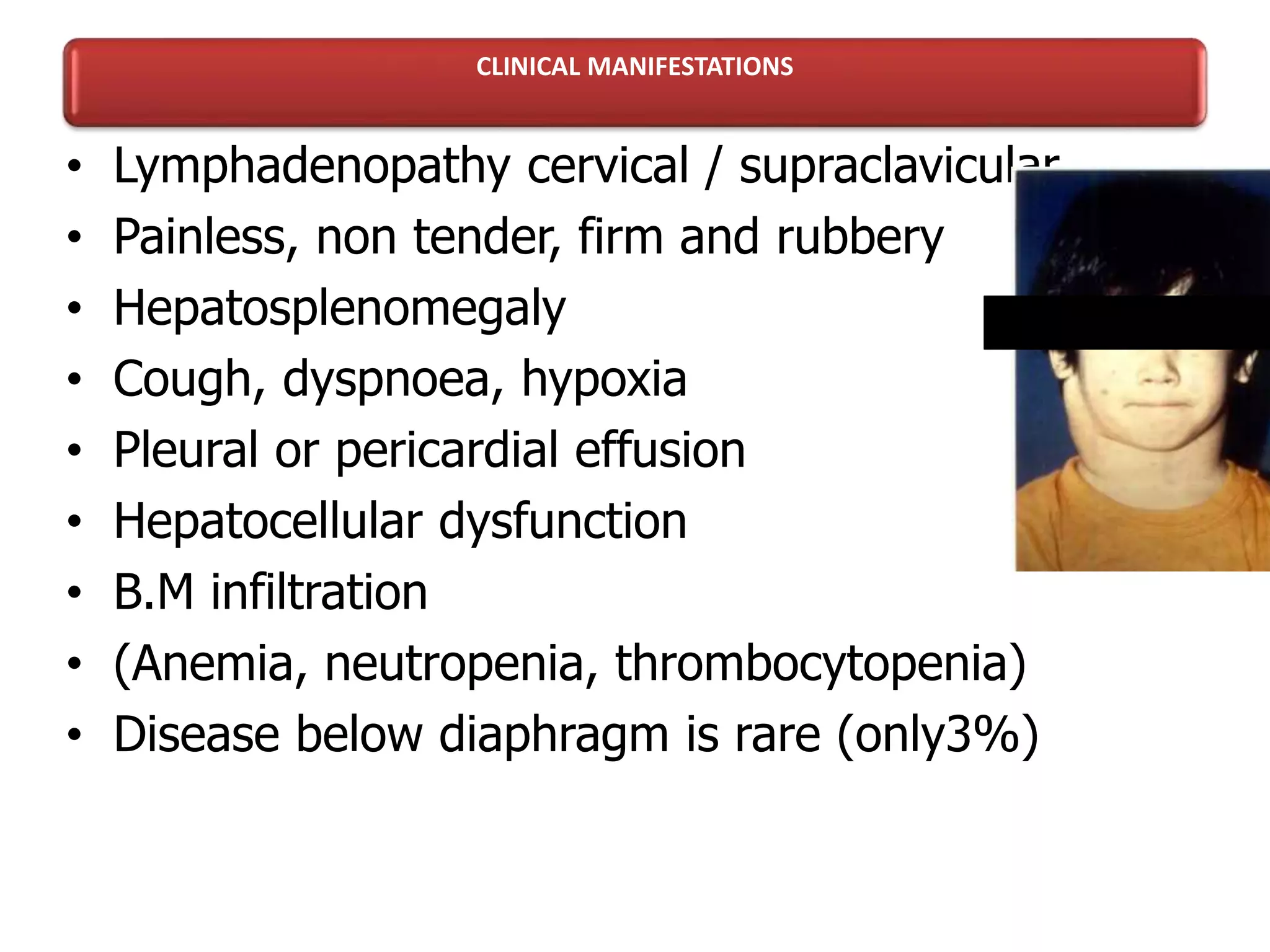 Lymphoma in children Dr G.Rajkumar | PPTX