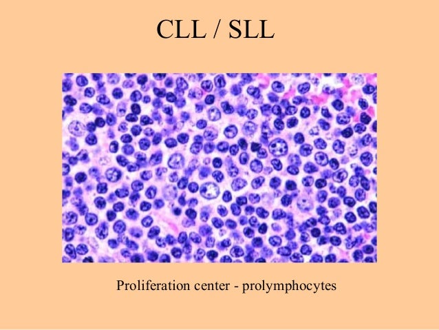 Lymphomas 1-nhl