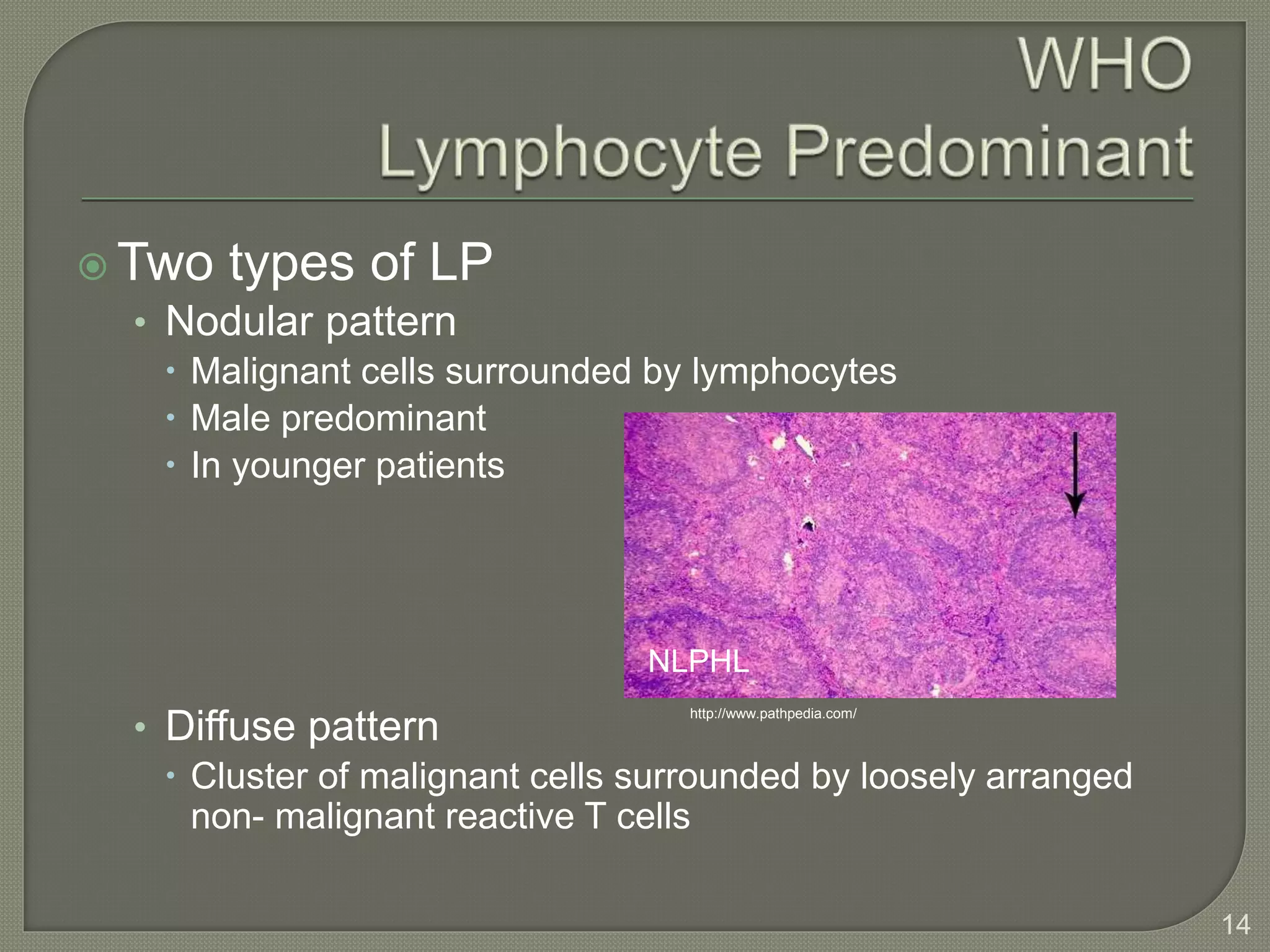 Lymphomas+ Multiple Choice Questions | PPTX