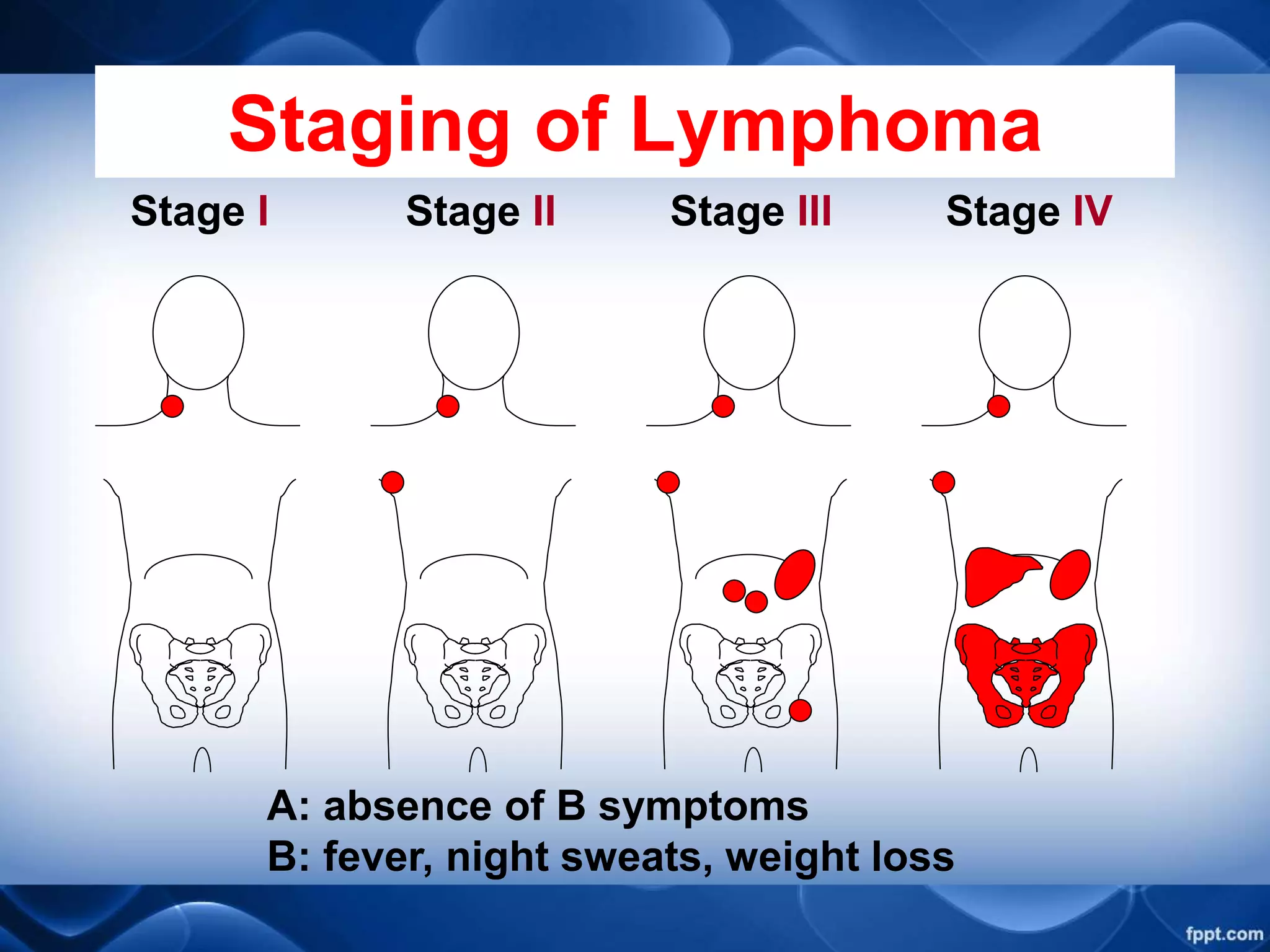 Lymphomas: Hodgkin & Non Hodgkin by Dr. Sookun Rajeev Kumar | PPTX ...