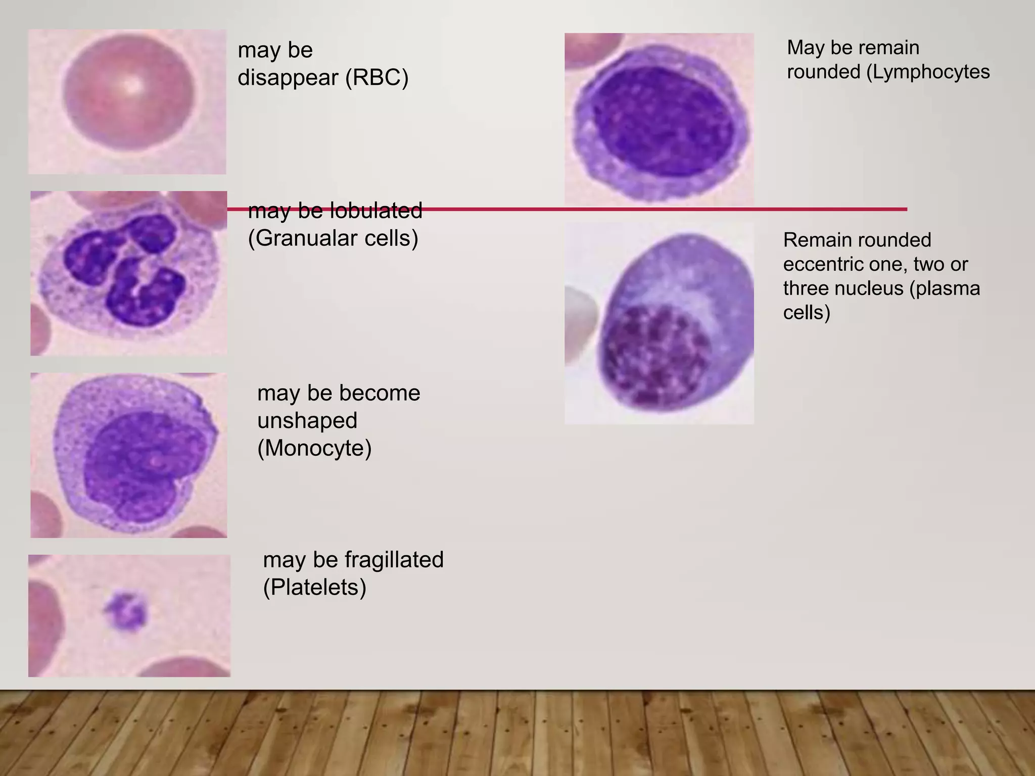 Lymphopoiesis-.ppt