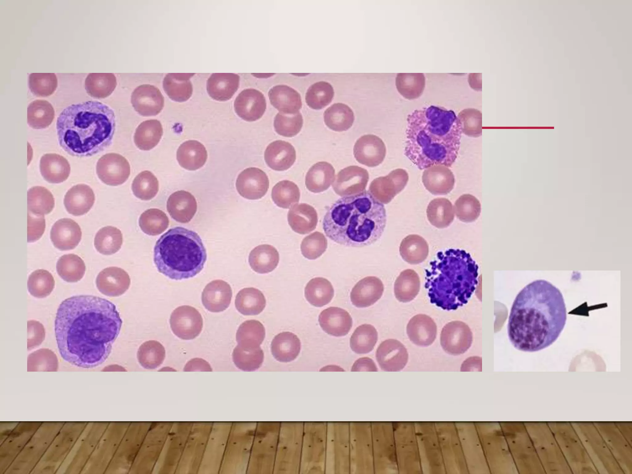 Lymphopoiesis-.ppt