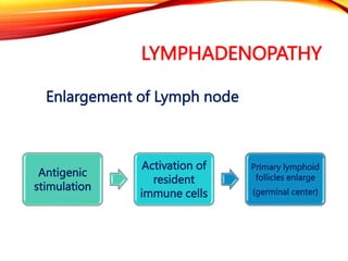 Lymphoreticular .pptx