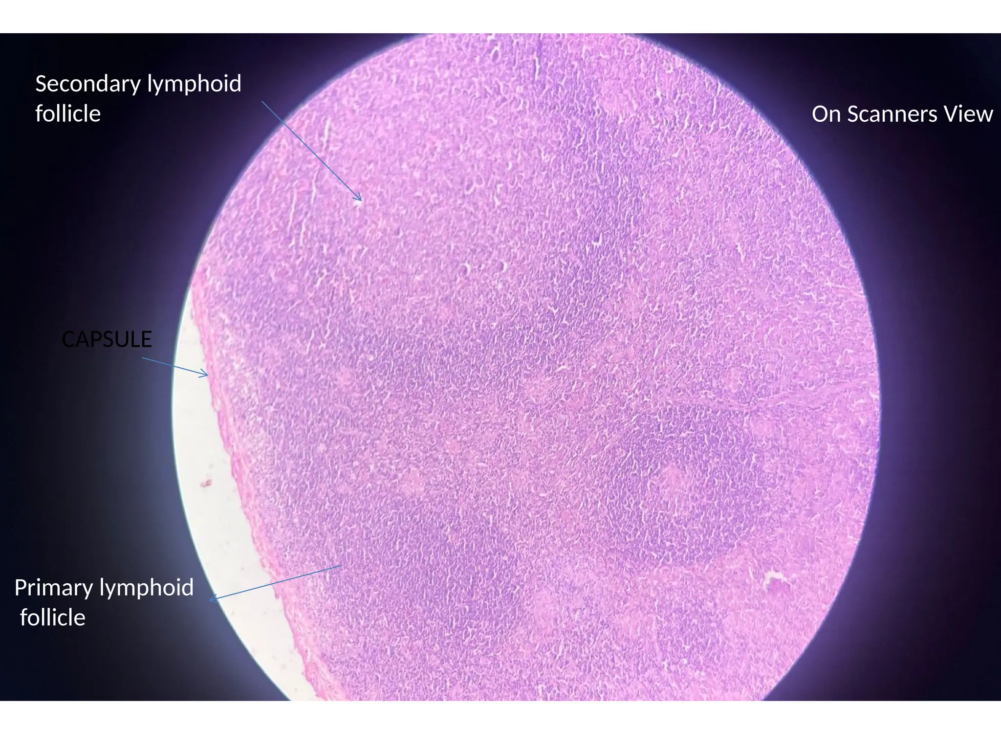 LYMPHORETICULAR SYSTEM SLIDE SEMINAR.pptx