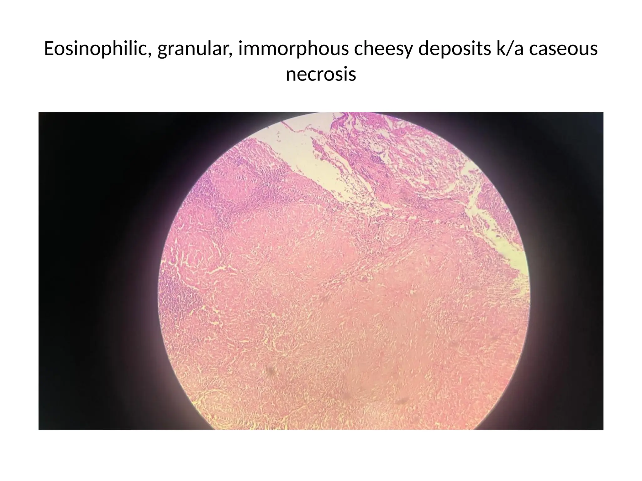 LYMPHORETICULAR SYSTEM SLIDE SEMINAR.pptx