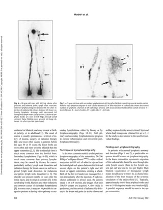 Lymphoscintigraphy lymphedema of extremities_Pictorial Essay.pdf
