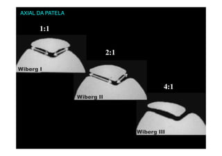 PROTOCOLO DE LYON EM TOMOGRAFIA COMPUTADORIZADA.pdf