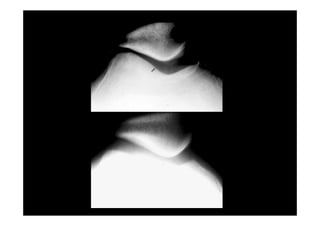 PROTOCOLO DE LYON EM TOMOGRAFIA COMPUTADORIZADA.pdf
